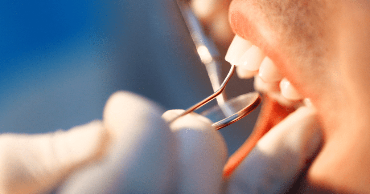 Alveolitis Dental: Síntomas Y Tratamiento | Ramis Gandía